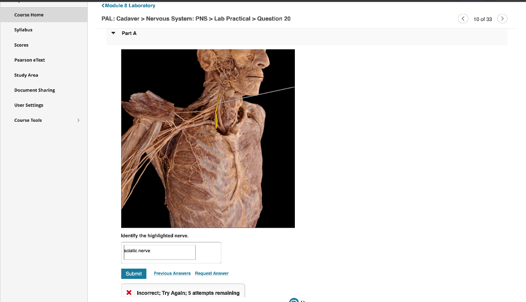 Solved Pal Cadaver Nervous System Pns Lab Practical