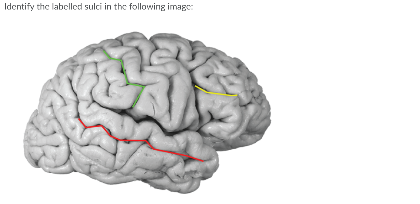 Solved Identify the labelled sulci in the following image: | Chegg.com