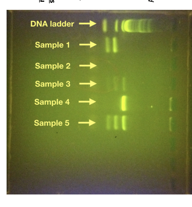 Solved DNA ladder Sample 1 Sample 2 Sample 3 Sample 4 - | Chegg.com