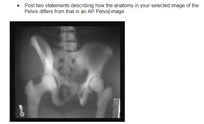 Solved Post two statements describing how the anatomy in | Chegg.com