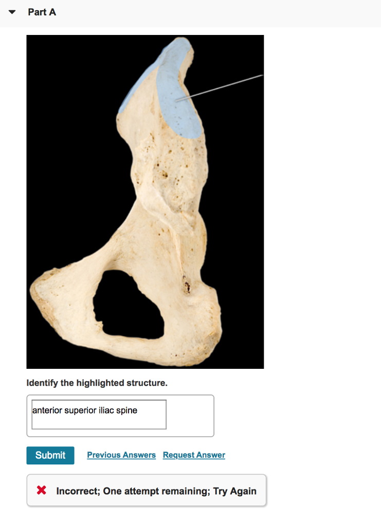 Solved PartA Identify the highlighted structure. anterior | Chegg.com