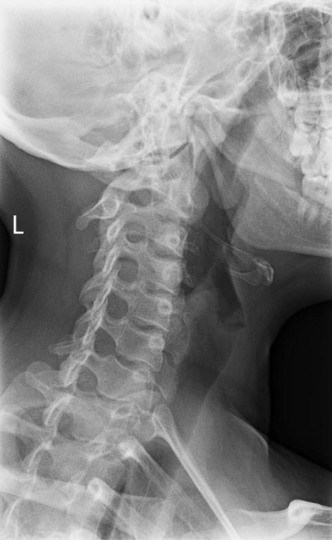 Solved Give exact location of the L3 inferior articulating | Chegg.com