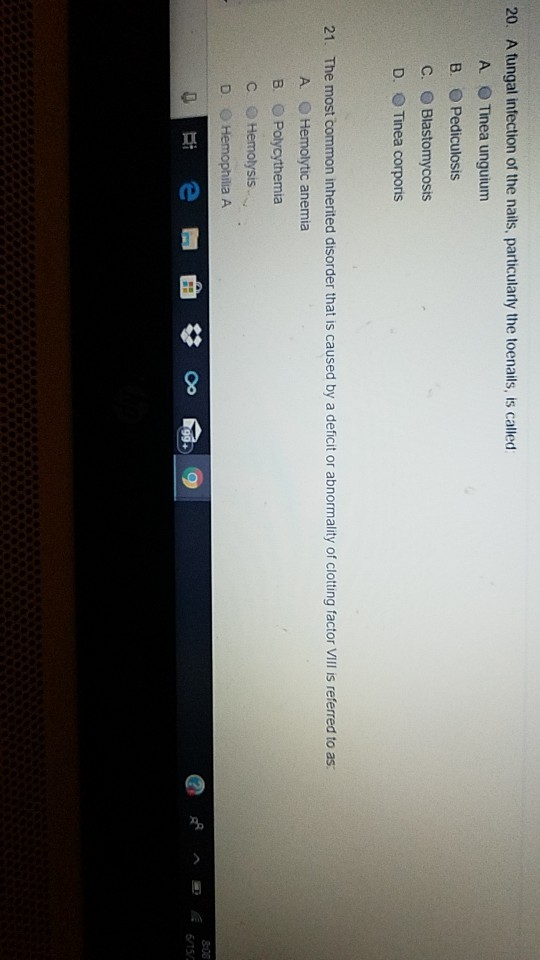 Solved EC demauts may be caused by A OViral infections or a | Chegg.com