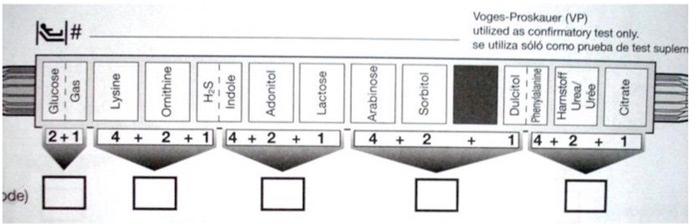 Solved Enterotube: Purpose of the test Obtained code: Name | Chegg.com