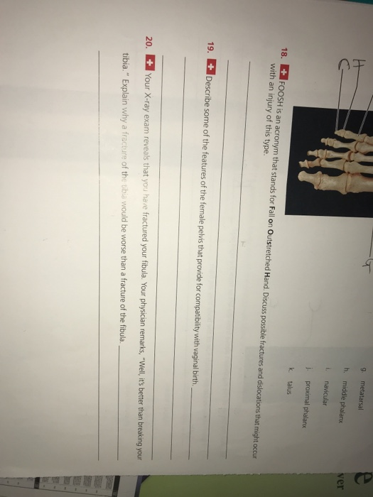 Solved ver 18. FOOSH is an acronym that stands for Fall on | Chegg.com