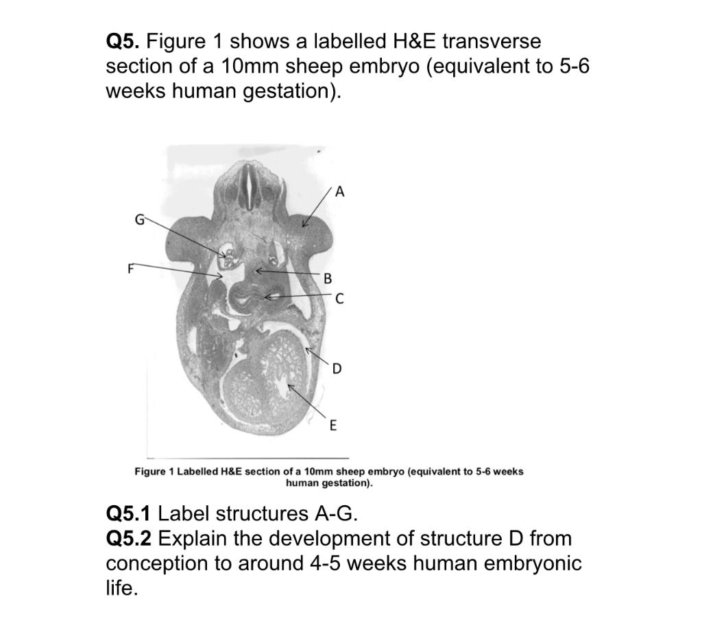 Solved Q5. Figure 1 shows a labelled H&E transverse section | Chegg.com