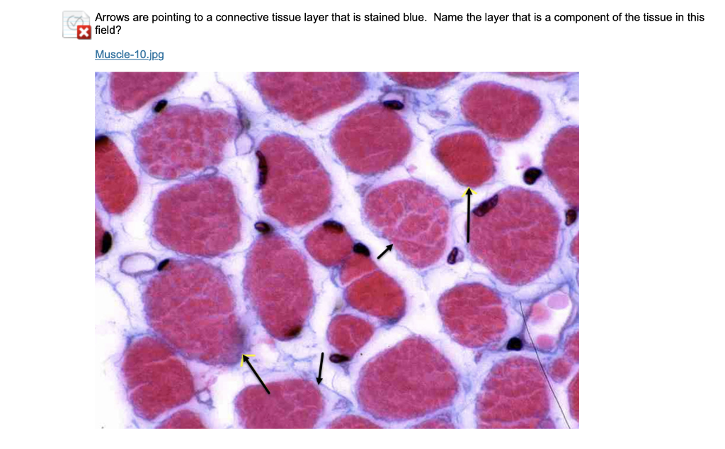 Solved Arrows are pointing to a connective tissue layer that | Chegg.com