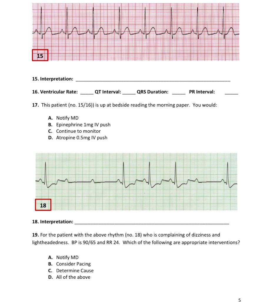 Solved 16. Ventricular Rate: QT Interval: QRS Duration: PR | Chegg.com