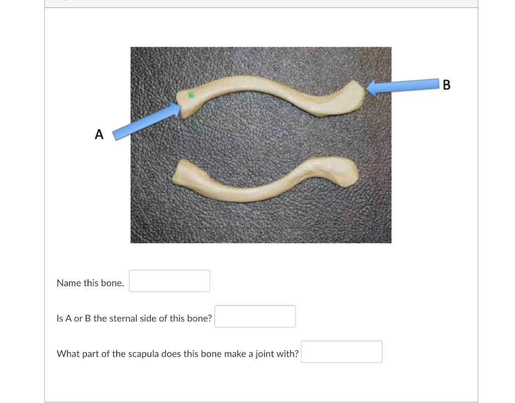 Name this bone. Is A or B the sternal side of this | Chegg.com