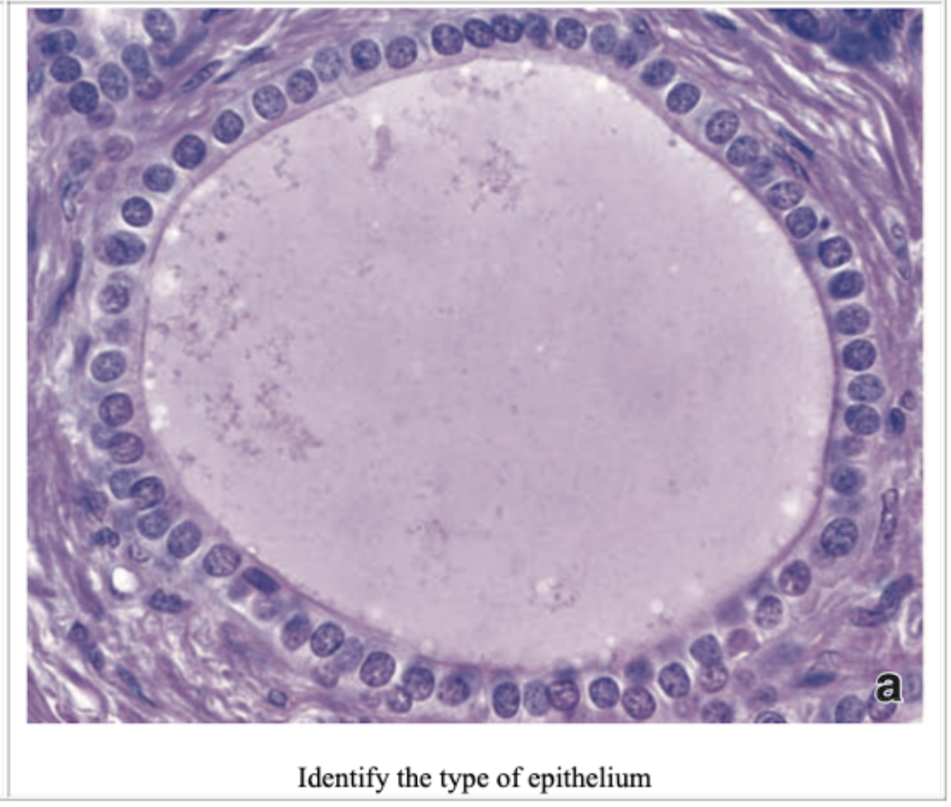 Solved Identify the type of epithelium | Chegg.com
