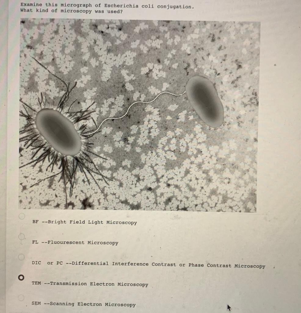 Solved Examine this micrograph of Synecococcus elongatus. | Chegg.com