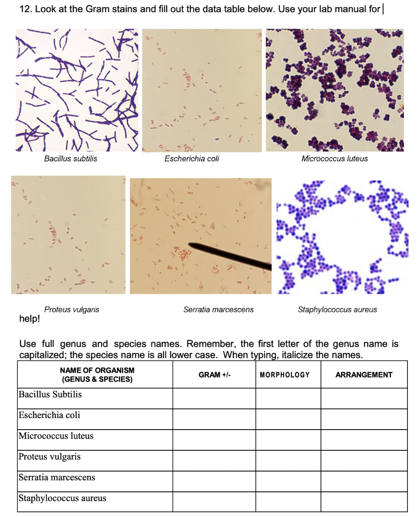 Proteus Mirabilis Gram Stain
