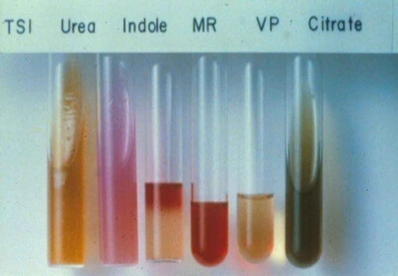 Solved TSI Urea Indole MR VP: Citrate | Chegg.com