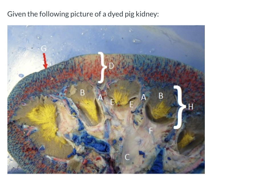 Solved Given the following picture of a dyed pig kidney: B | Chegg.com