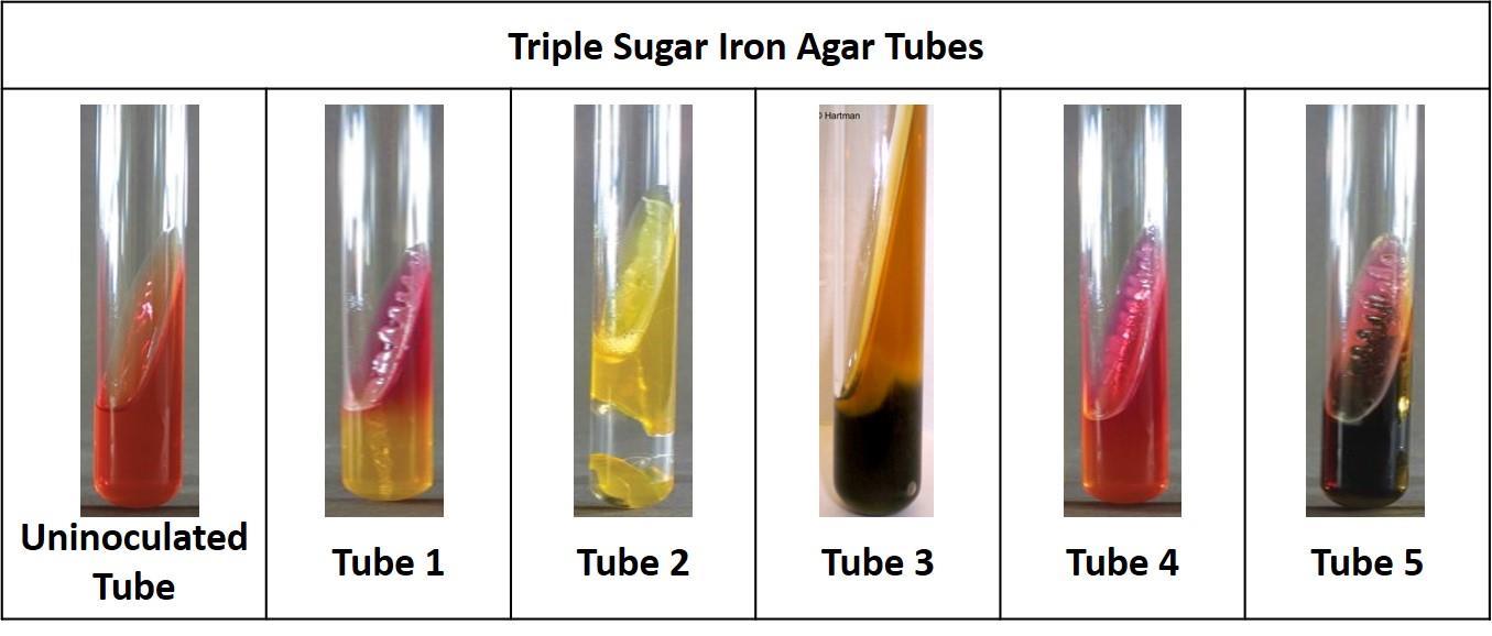 Triple Sugar Iron Agar
