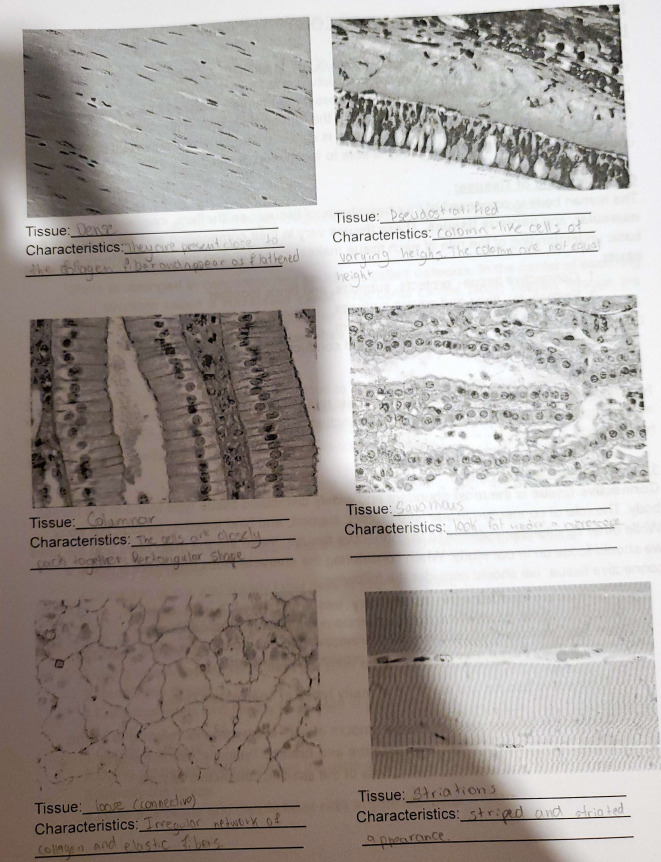 Solved Tissue: Dense Characteristics:- Tissue: | Chegg.com