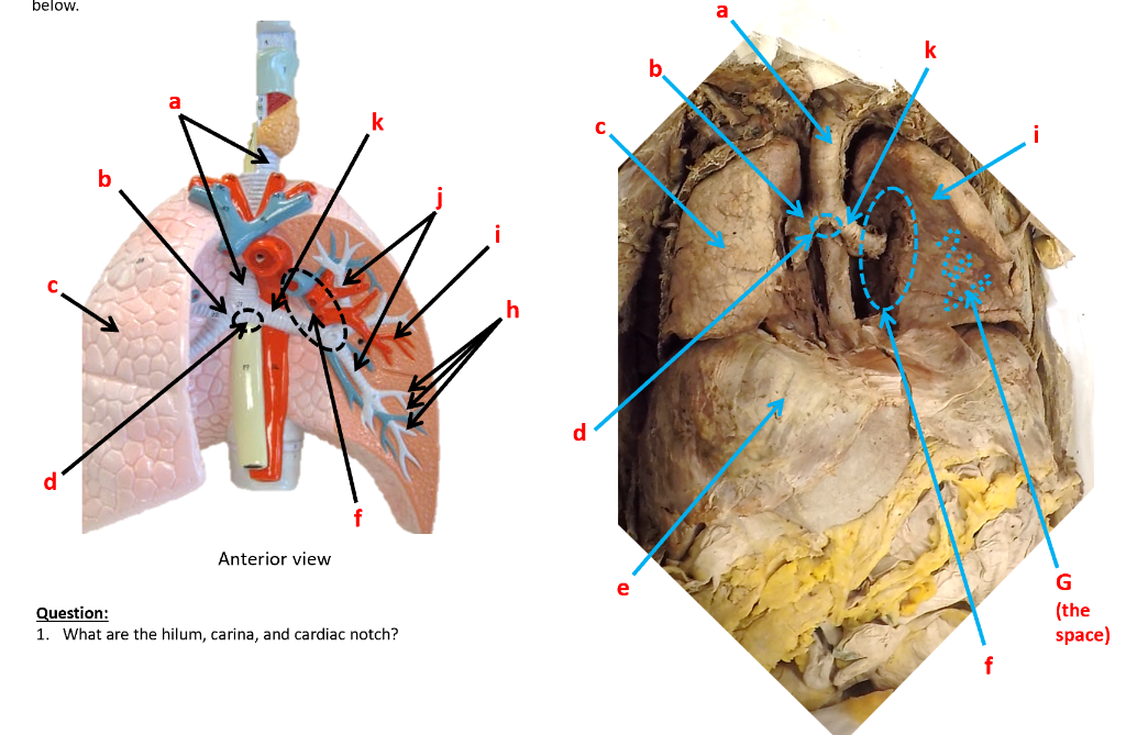 Solved Station 4: Anatomy of the Lungs R/L | Chegg.com