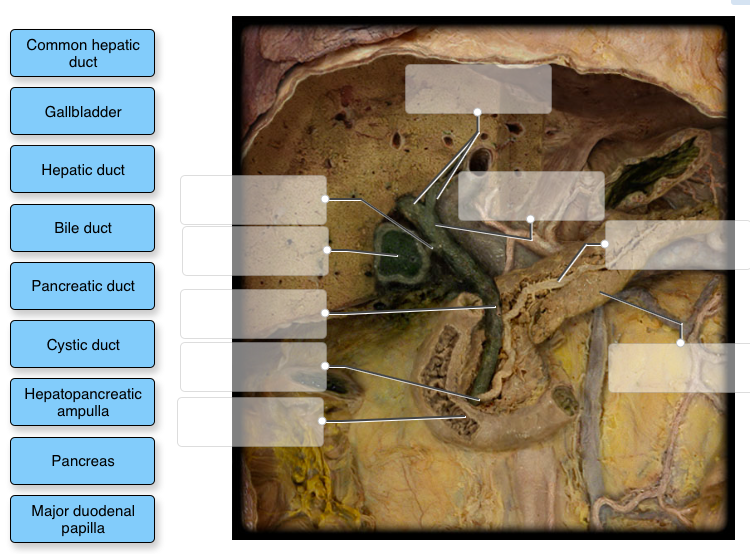 Hepatopancreatic Ampulla Duodenal Duct