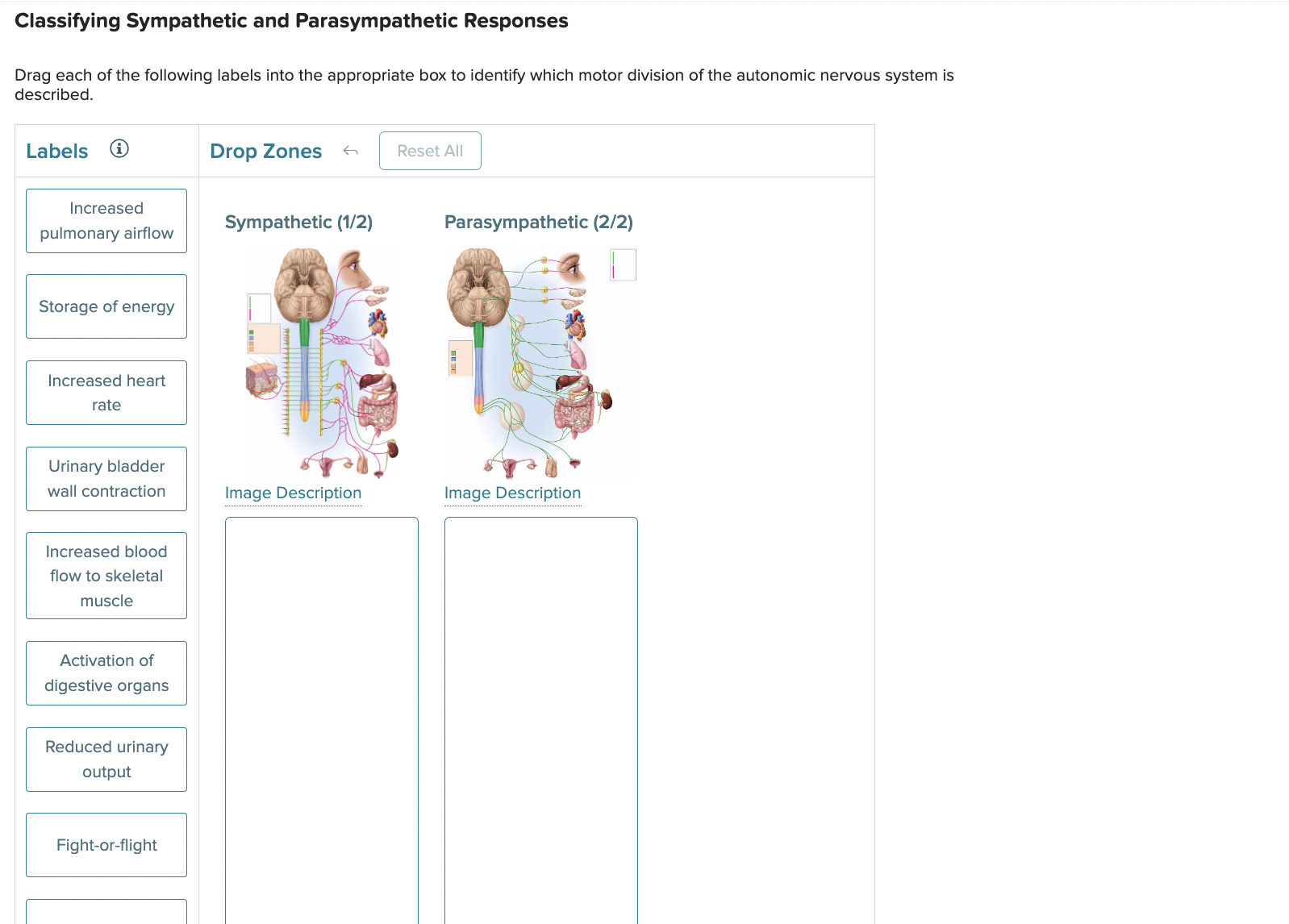 Solved Classifying Sympathetic and Parasympathetic | Chegg.com