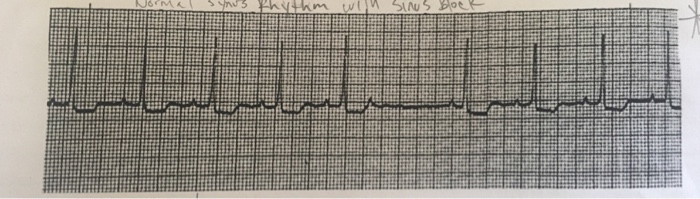 Solved Interpret the following ECG, 6 second | Chegg.com