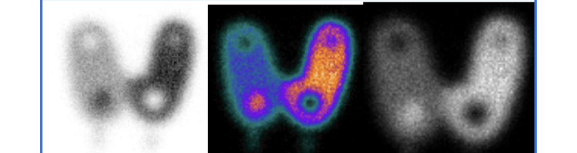 Solved The gamma camera was moved to be 5 cm away from the | Chegg.com