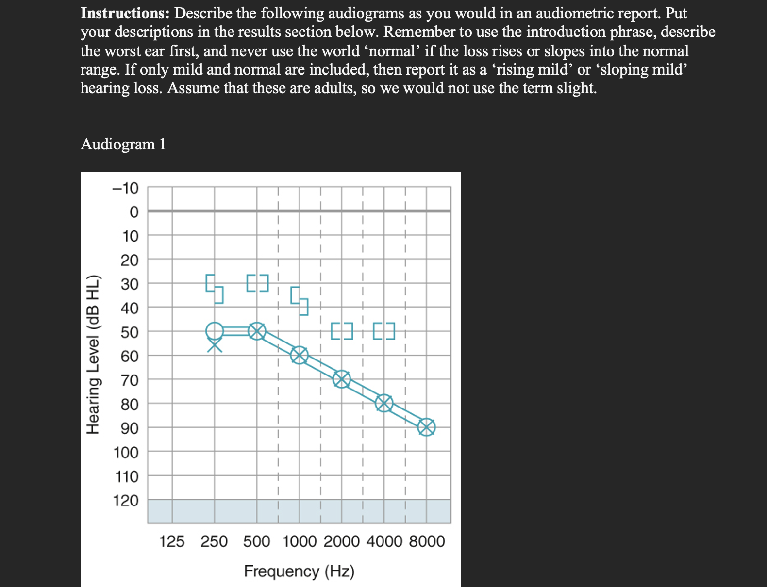 Solved Instructions: Describe the following audiograms as | Chegg.com