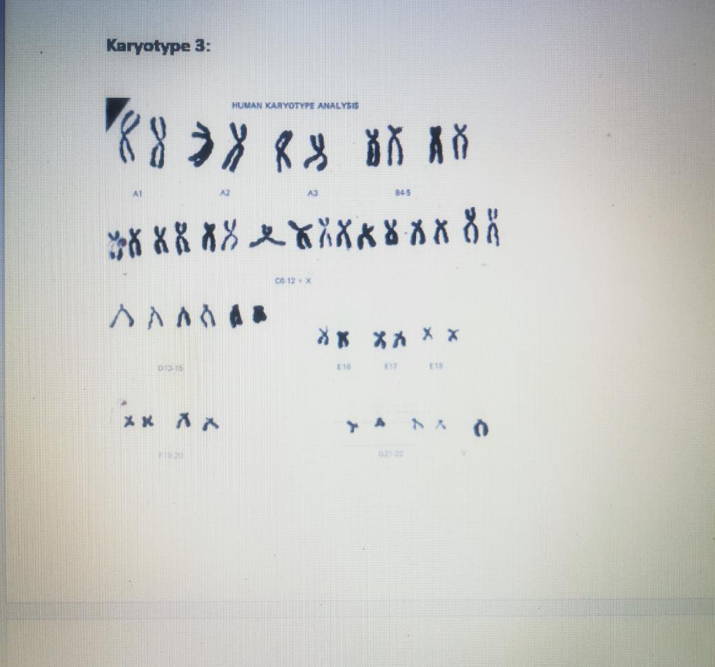 Solved Paragraph Question 6 - Human Karyotype Analysis (10 | Chegg.com