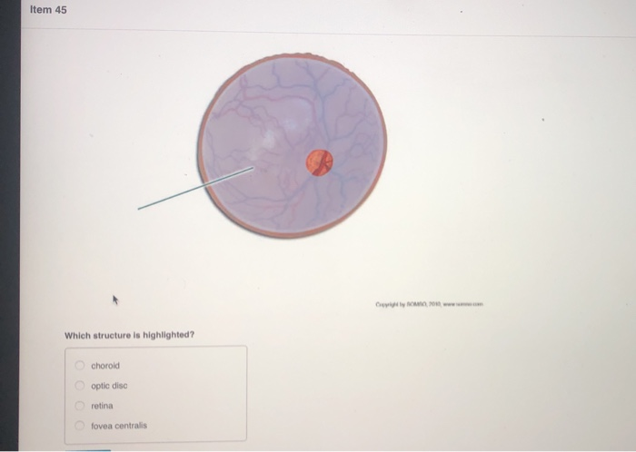 Solved Item 45 Cigt y On 0 Which structure is highlighted? | Chegg.com