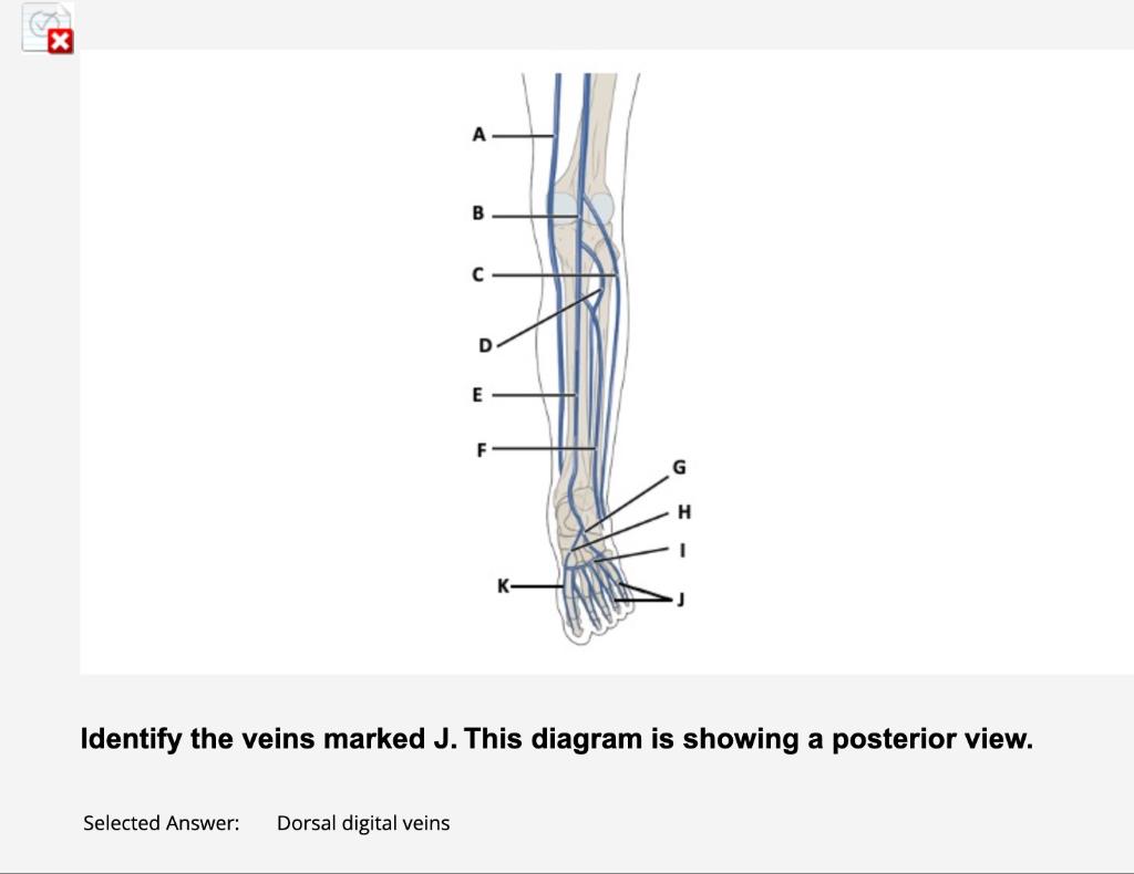 Solved Identify the vein marked I. This diagram is showing a | Chegg.com