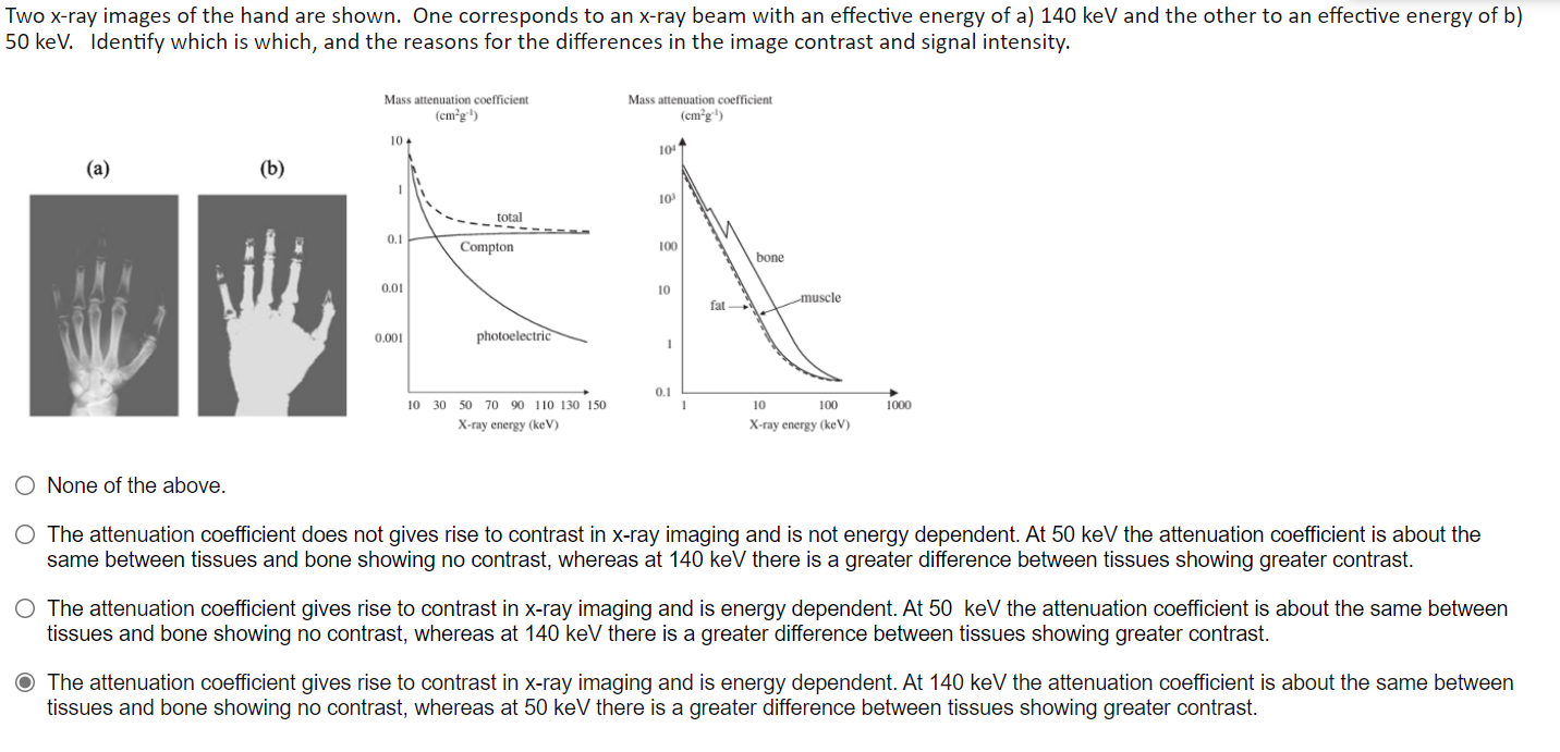 Solved Two X-ray images of the hand are shown. One | Chegg.com