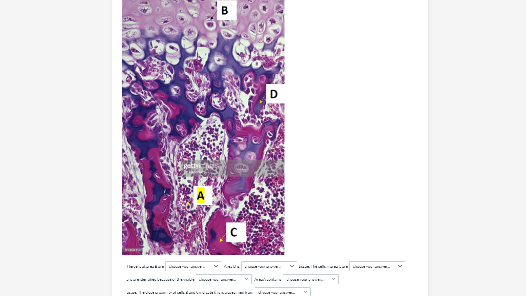Solved Options Set 1 -Chondroblasts, osteoblasts, | Chegg.com