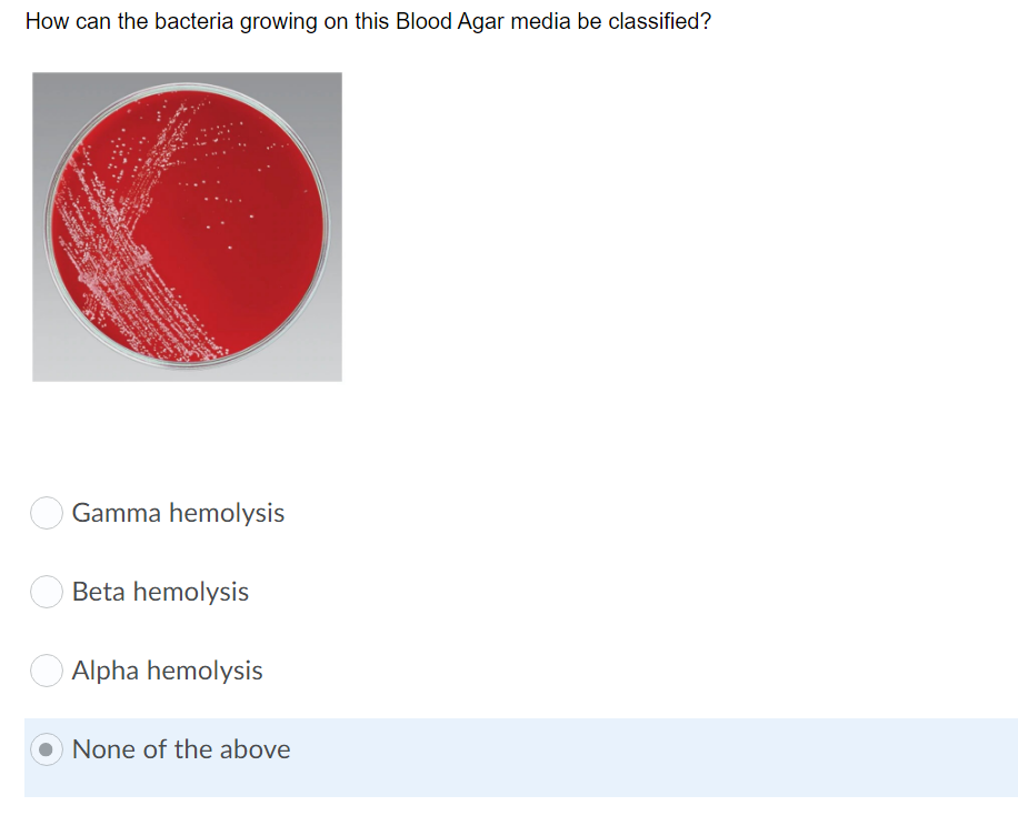 How can the bacteria growing on this Blood Agar media | Chegg.com