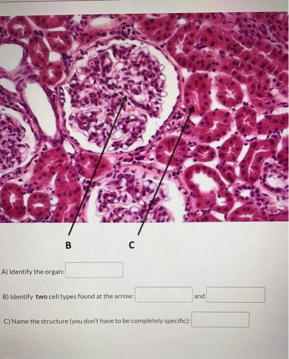 Solved B C A) Identify the organ: B) Identify two cell types | Chegg.com