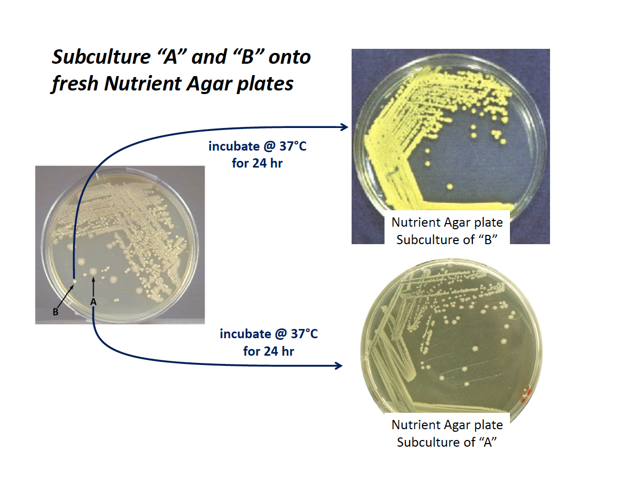 Solved Subculture and Colony | Chegg.com