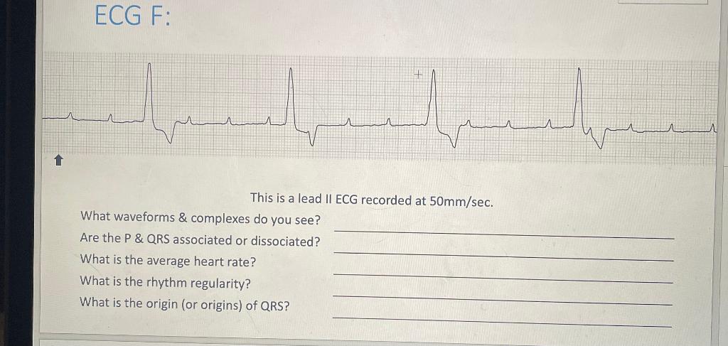 Solved Also, provide a RHYTHM DIAGNOSIS ECG, the options | Chegg.com