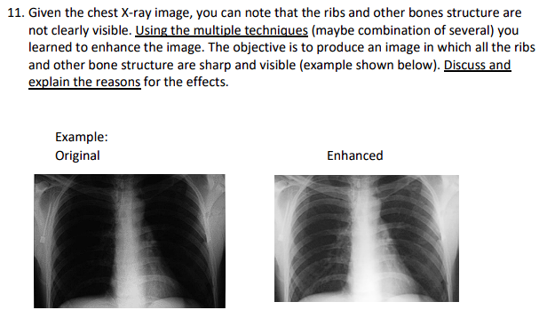 Solved Digital Image Processing | Chegg.com