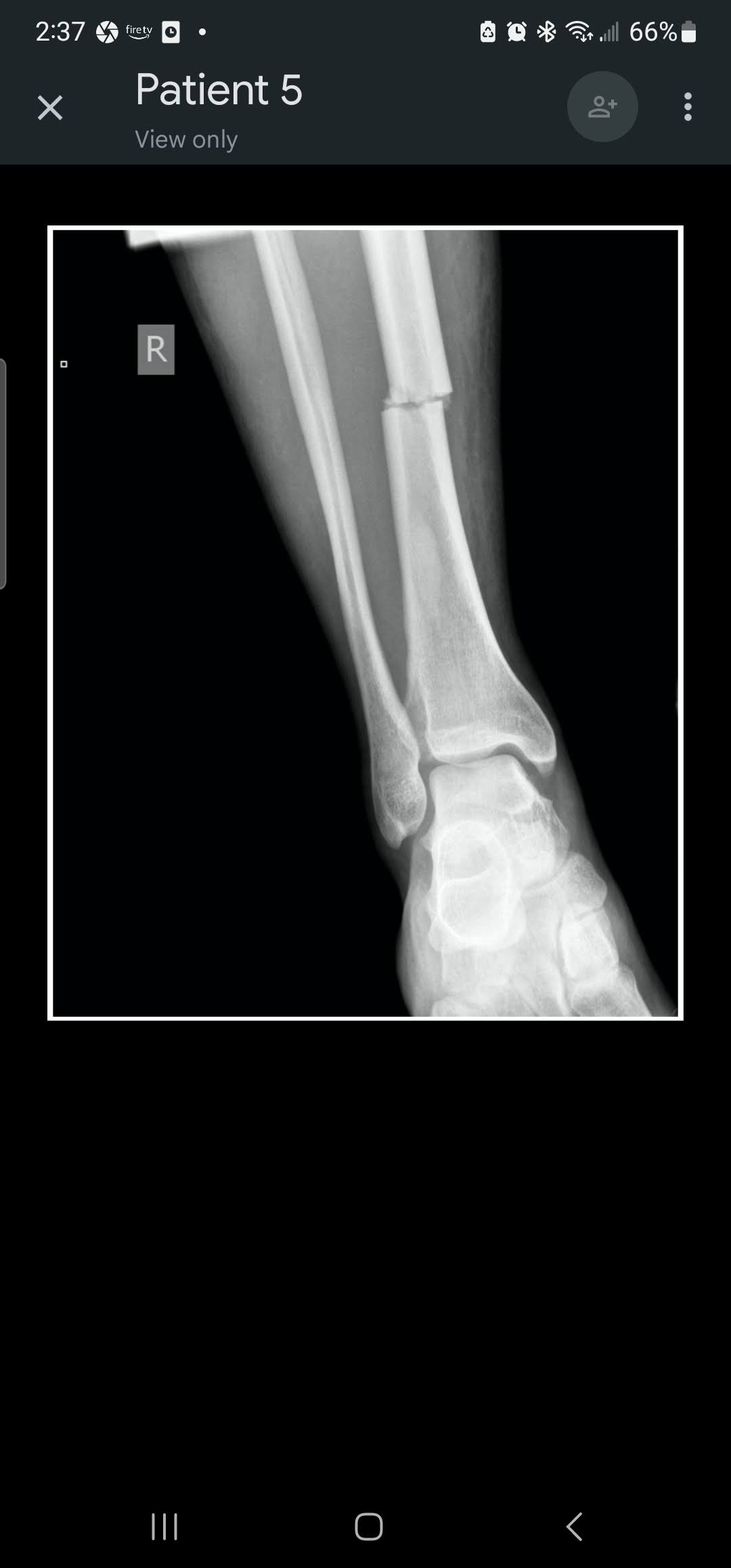 Help answer the questions using the xrays | Chegg.com