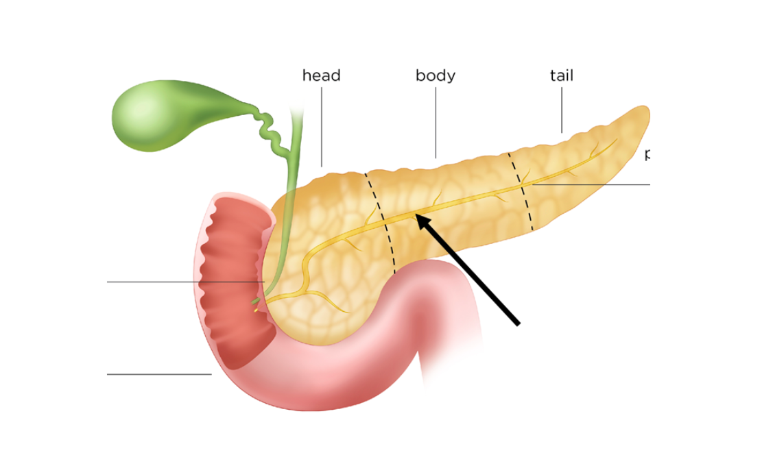 Solved head body tail | Chegg.com