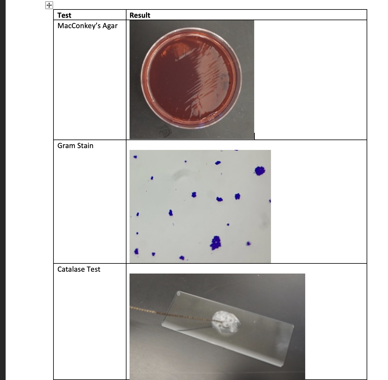 Solved Interpret these microbiology findings. | Chegg.com