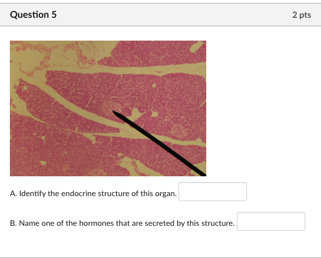 Solved Question 5 2 pts A. Identify the endocrine structure | Chegg.com Solved Question 5 2 pts A. Identify the endocrine structure | Chegg.com