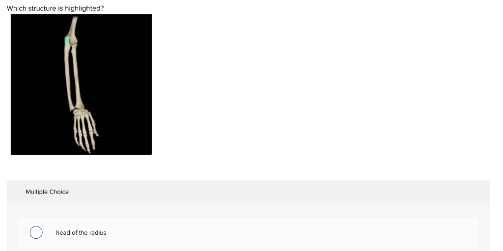 Solved Which structure is highlighted? Multiple Choice head | Chegg.com
