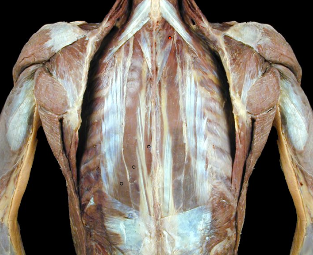 Semispinalis Capitis Cadaver