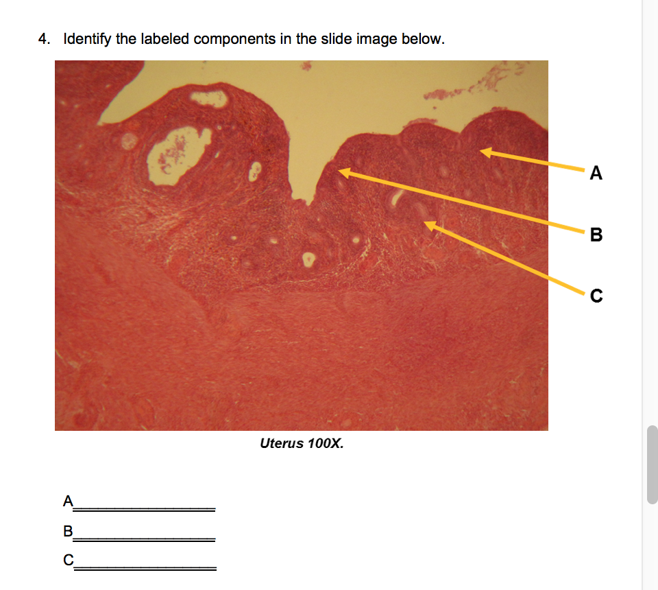 Uterus Slide Labeled