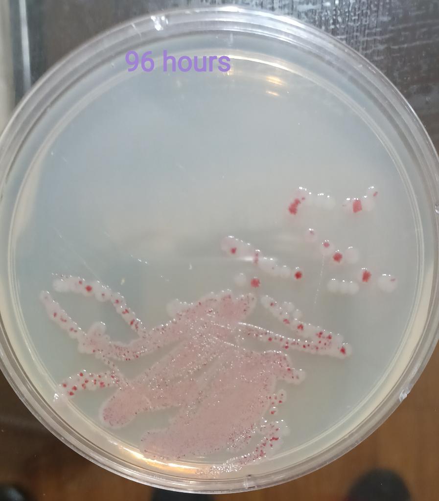 Solved Did you obtain isolated colonies of both organisms? | Chegg.com