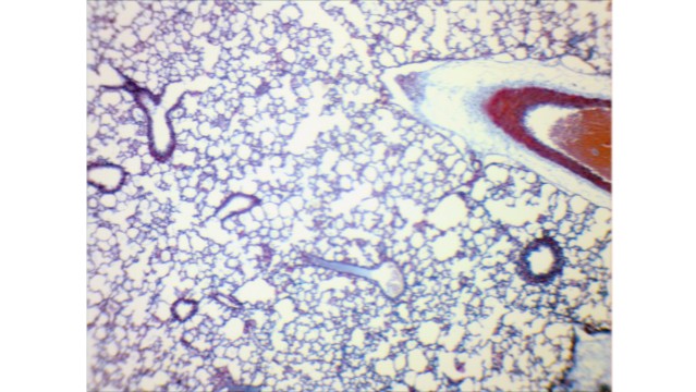 Solved From the Lung (simple squamous): Recognize slide at | Chegg.com