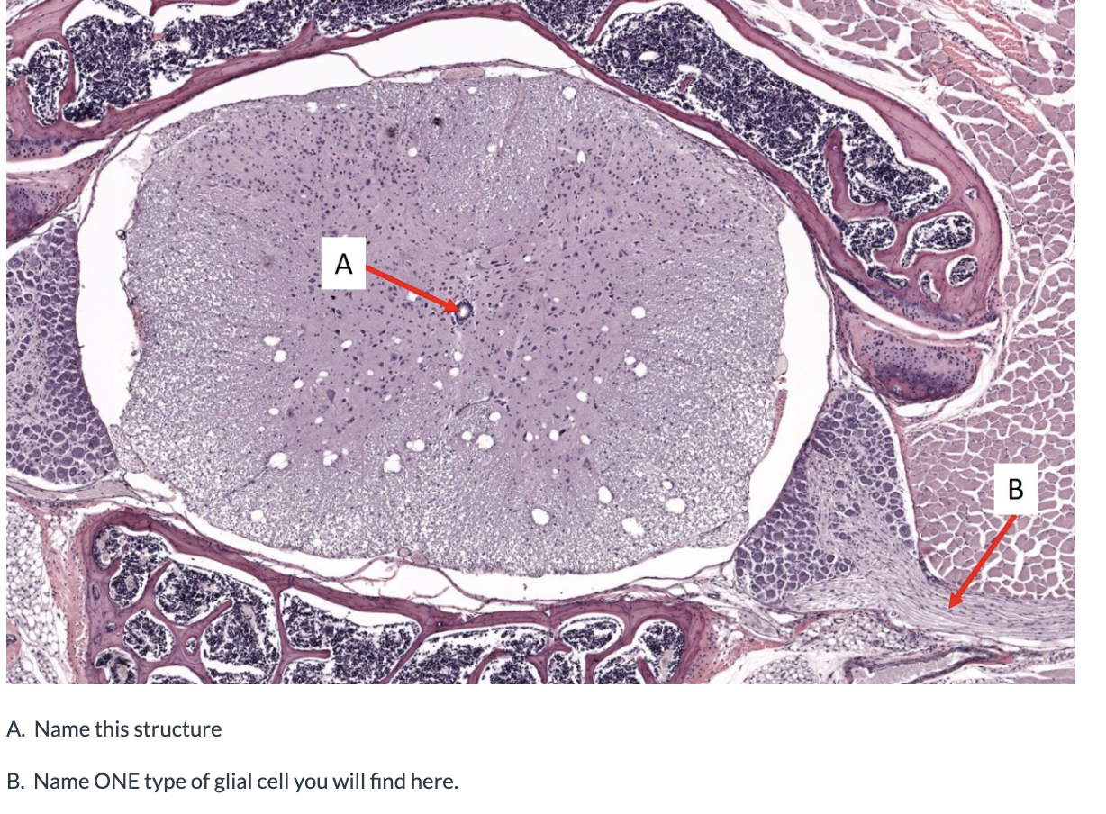 Solved A. Name this structure B. Name ONE type of glial cell | Chegg.com