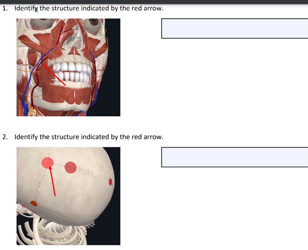 Solved 1. Identify the structure indicated by the red arrow. | Chegg.com