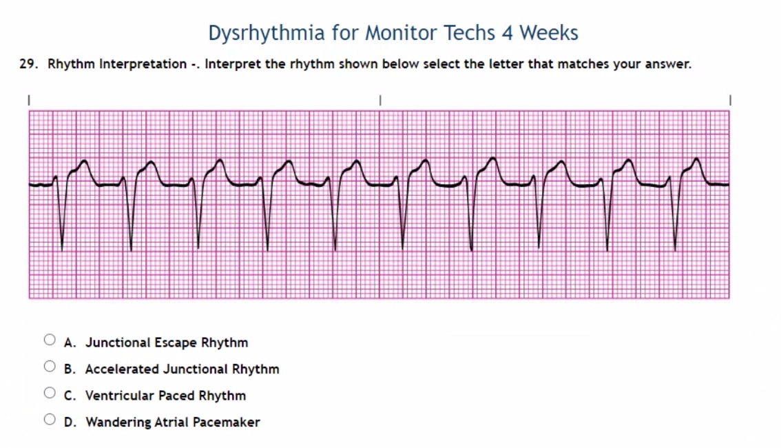 Solved Dysrhythmia for Monitor Techs 4 Weeks 29. Rhythm | Chegg.com