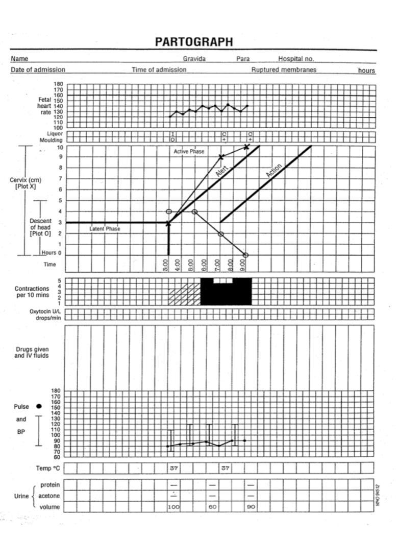Solved please use your keyboard Look at the partograph below | Chegg.com