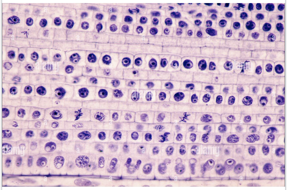Solved Count the number of cells in Interphase and the | Chegg.com